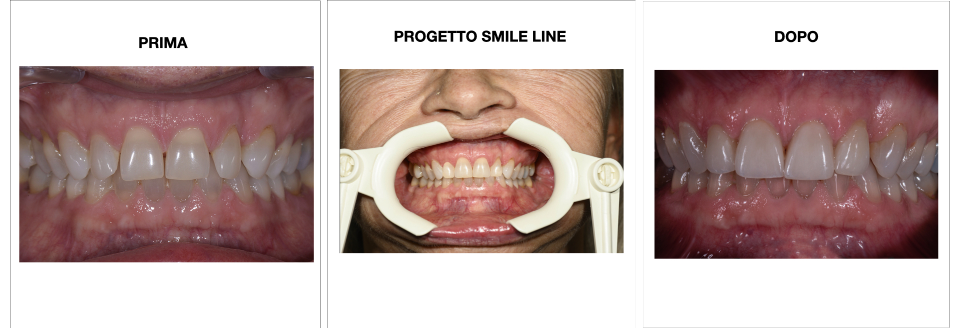 Smile Design | 3D Dental Project Swiss